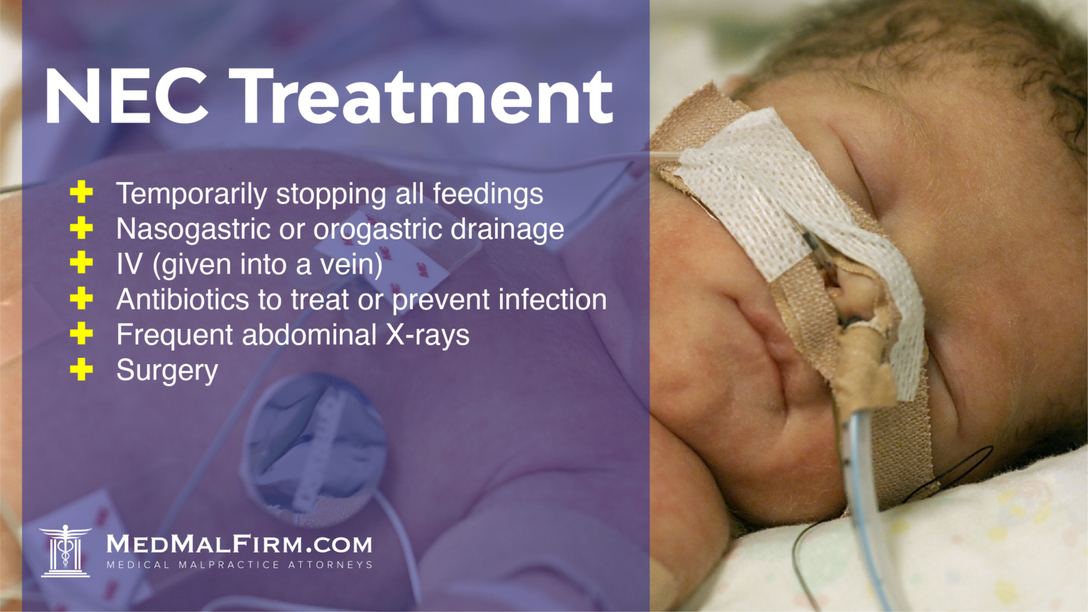 NEC Treatment | MedMalFirm.com