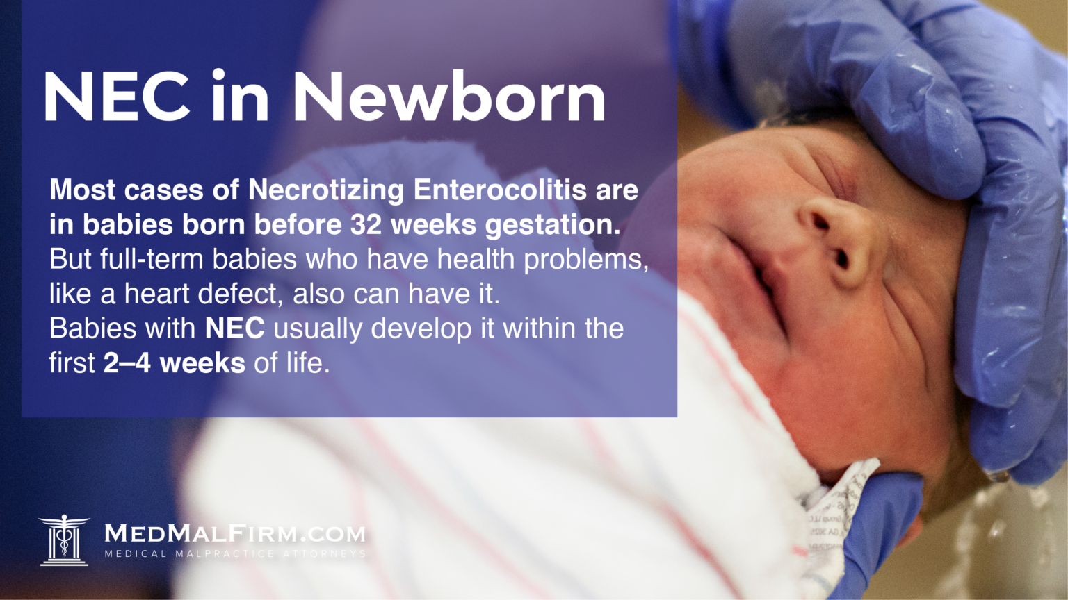 NEC in Newborns | MedMalFirm.com